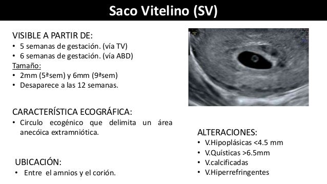 Ecografia del Primer Trimestre