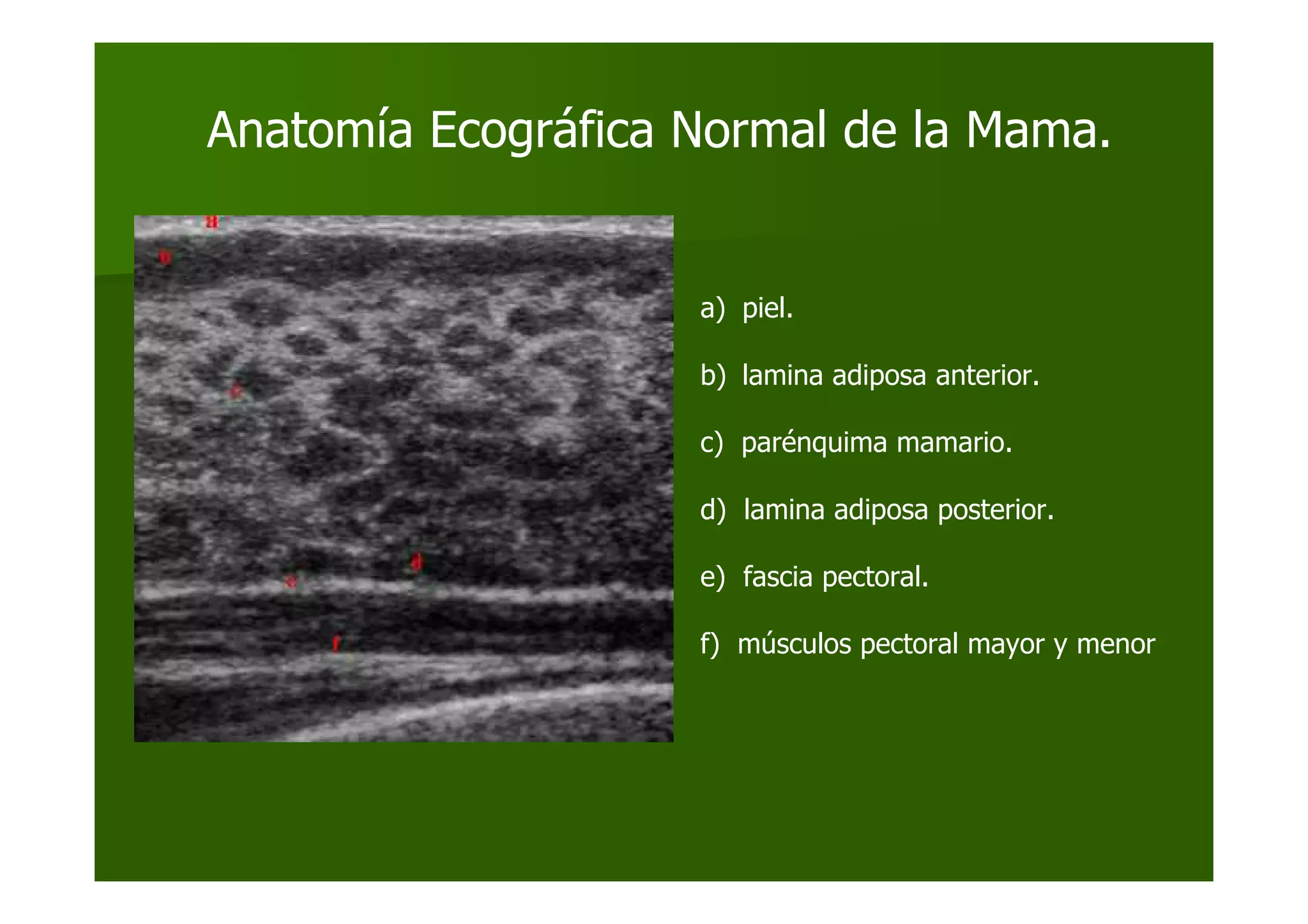 Ecografia de mama en atención primaria | PDF