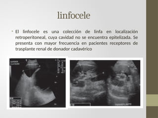 Ecografia de retroperitoneo ppt.pptx .. .. | PPTX