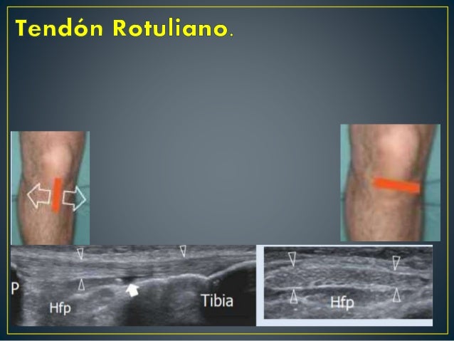 Ecografia de rodilla