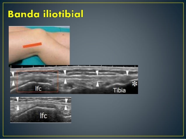 Ecografia de rodilla