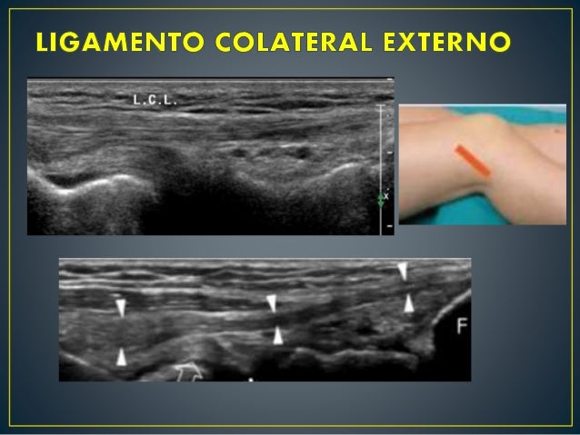 Ecografia de rodilla