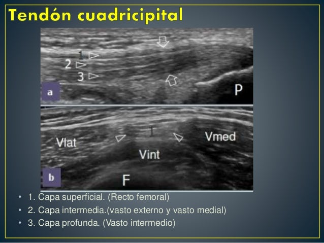 Ecografia de rodilla