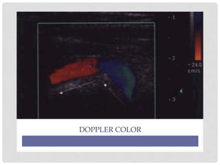 Ecografía Doppler | PDF