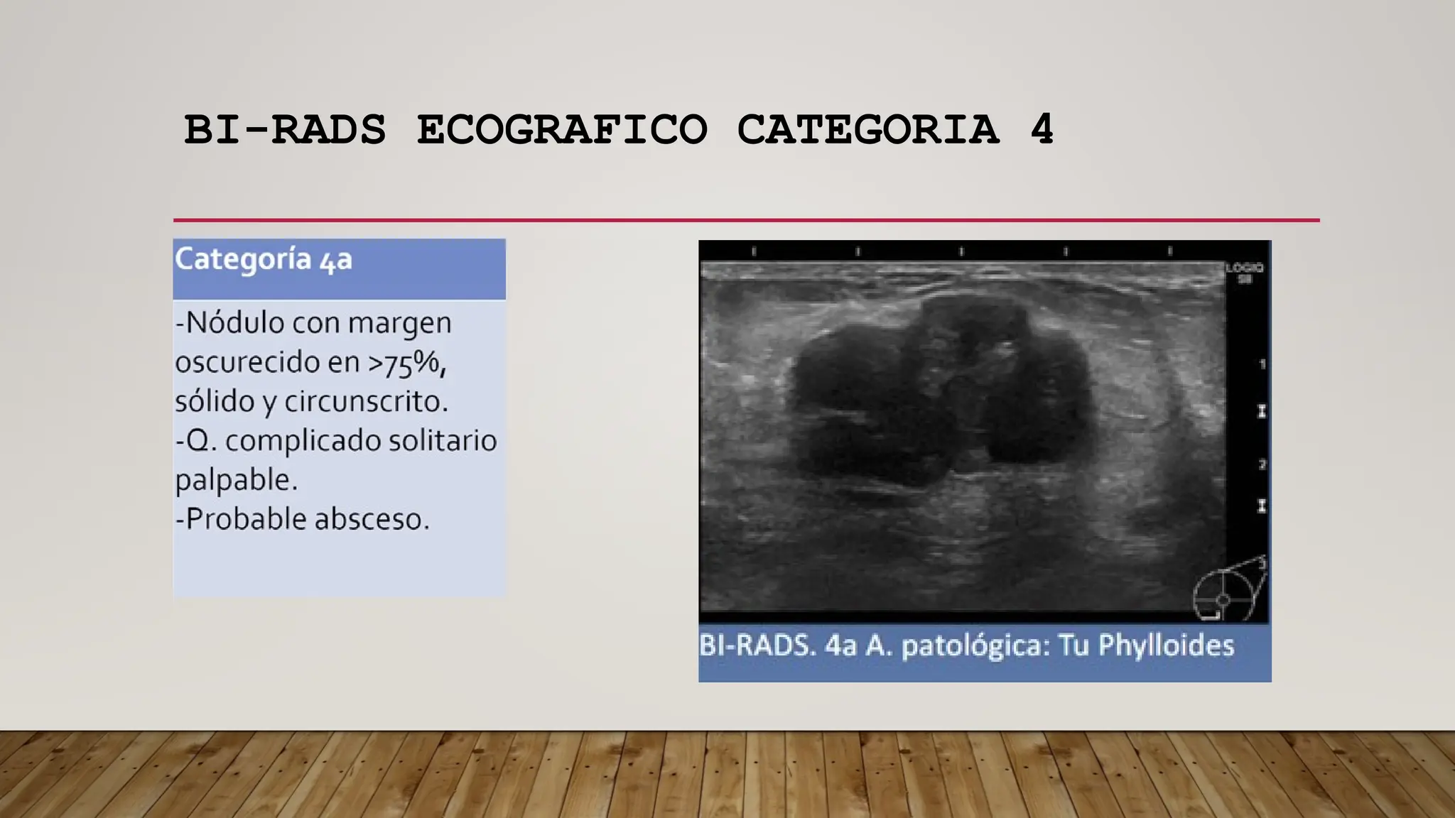 Ecografia mamaria y su clasificación BIRADS | PPTX