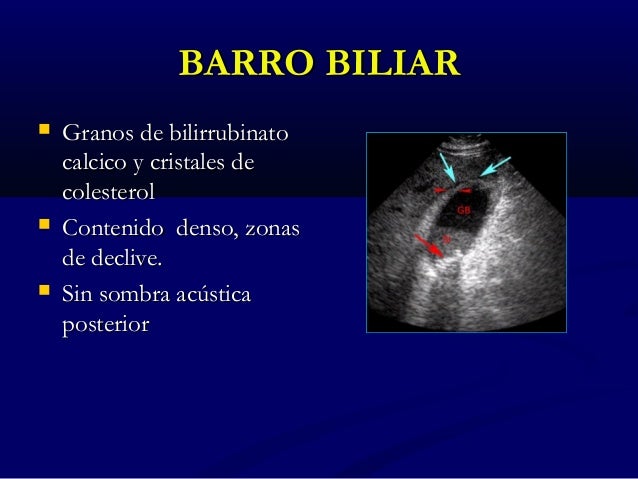Ecografia vesicula biliar