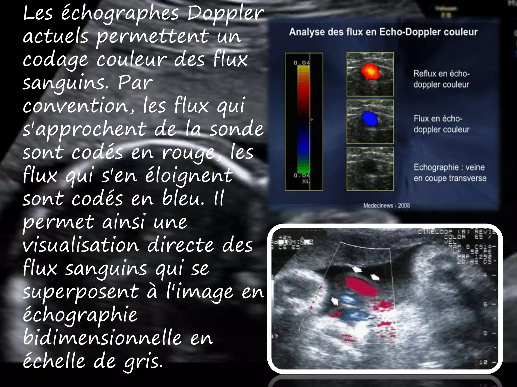 Ecographie | PPTX