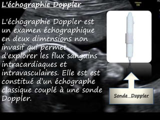 Ecographie | PPTX