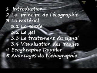 Ecographie | PPTX