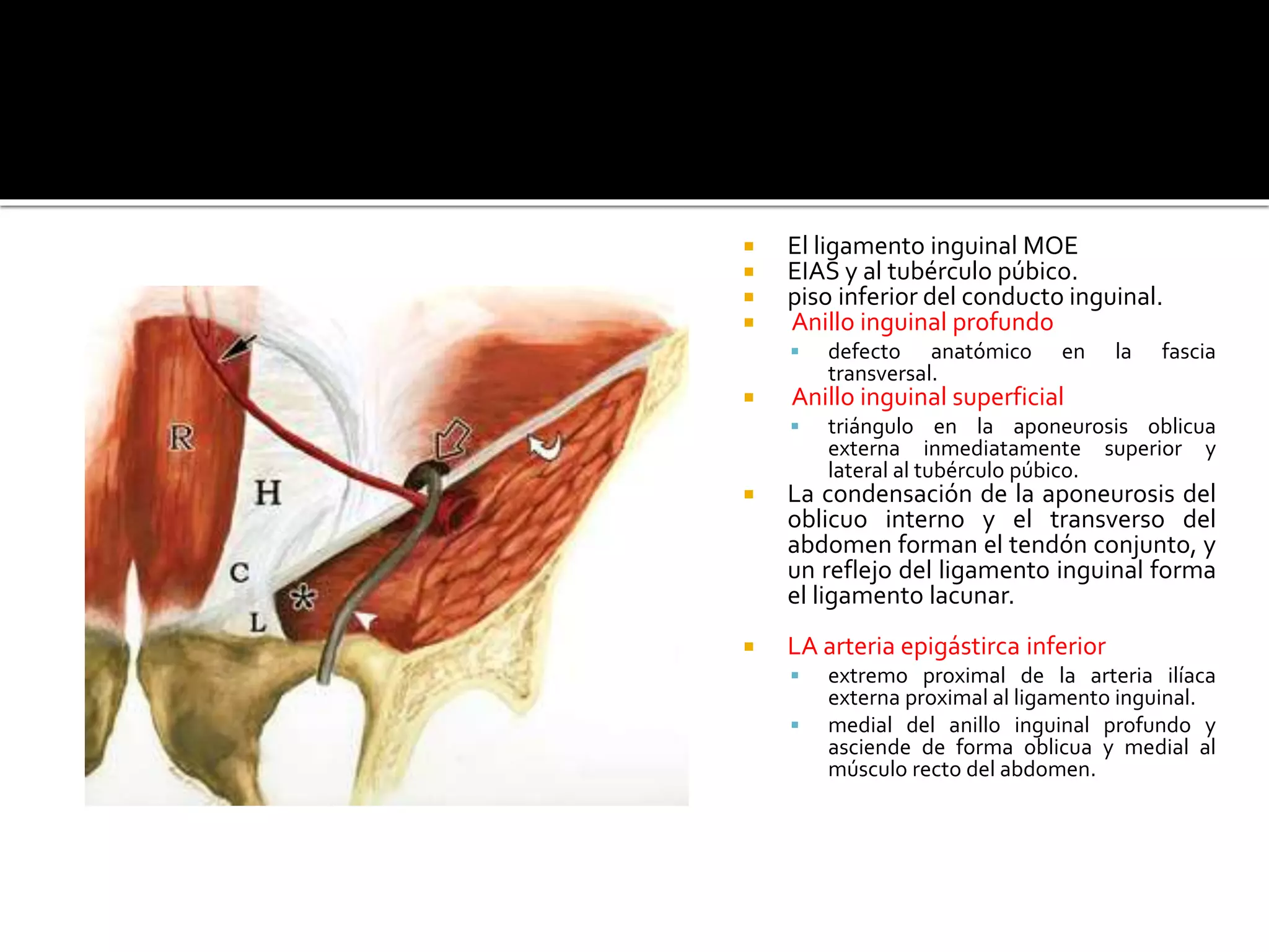 Ecografía inguinal. | PPTX
