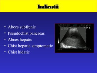 Ecografia interventionala in drenajul colectiilor abdominale | PPT