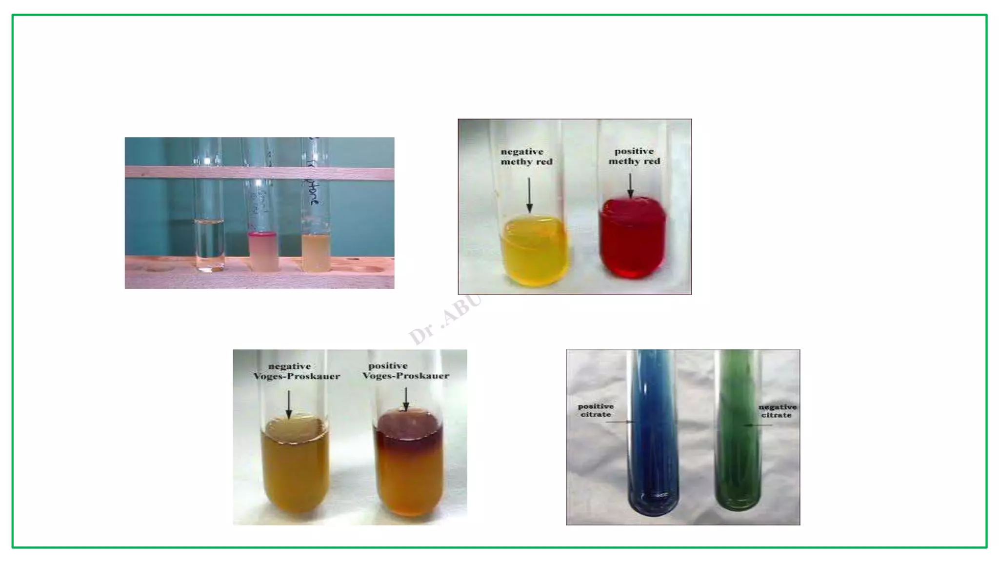 E coli - Microbiology | PPT