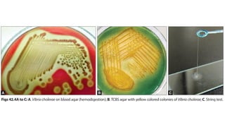 Ecoli diarrhea & Cholera: Pathogenesis and Lab diagnosis.pptx