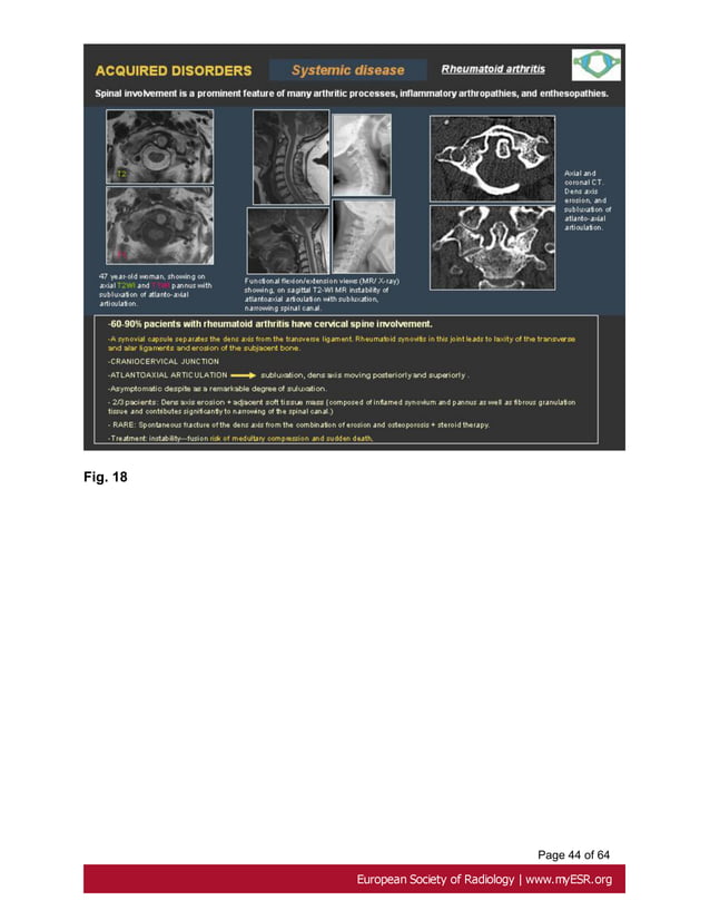 CVJ Anatomy | PDF | Death, Injury, or Military Conflict | Sensitive Topics