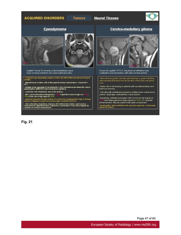 CVJ Anatomy | PDF | Death, Injury, or Military Conflict | Sensitive Topics