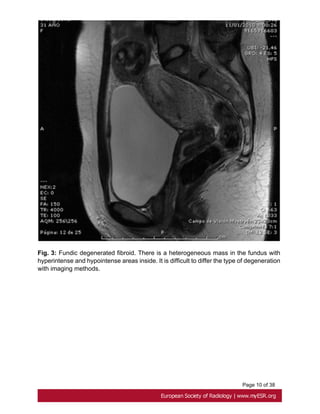 MRI of female pelvis as an atlas of image | PDF