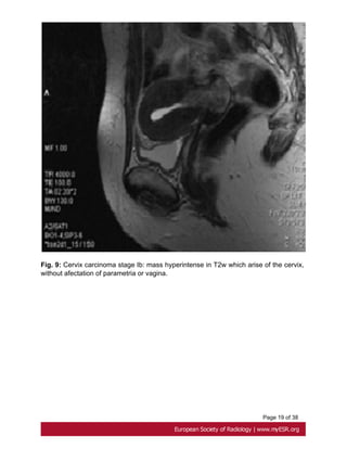 MRI of female pelvis as an atlas of image | PDF