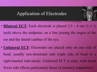 Electro convulsive therapy | PPTX | Brain and Nervous System Disorders ...