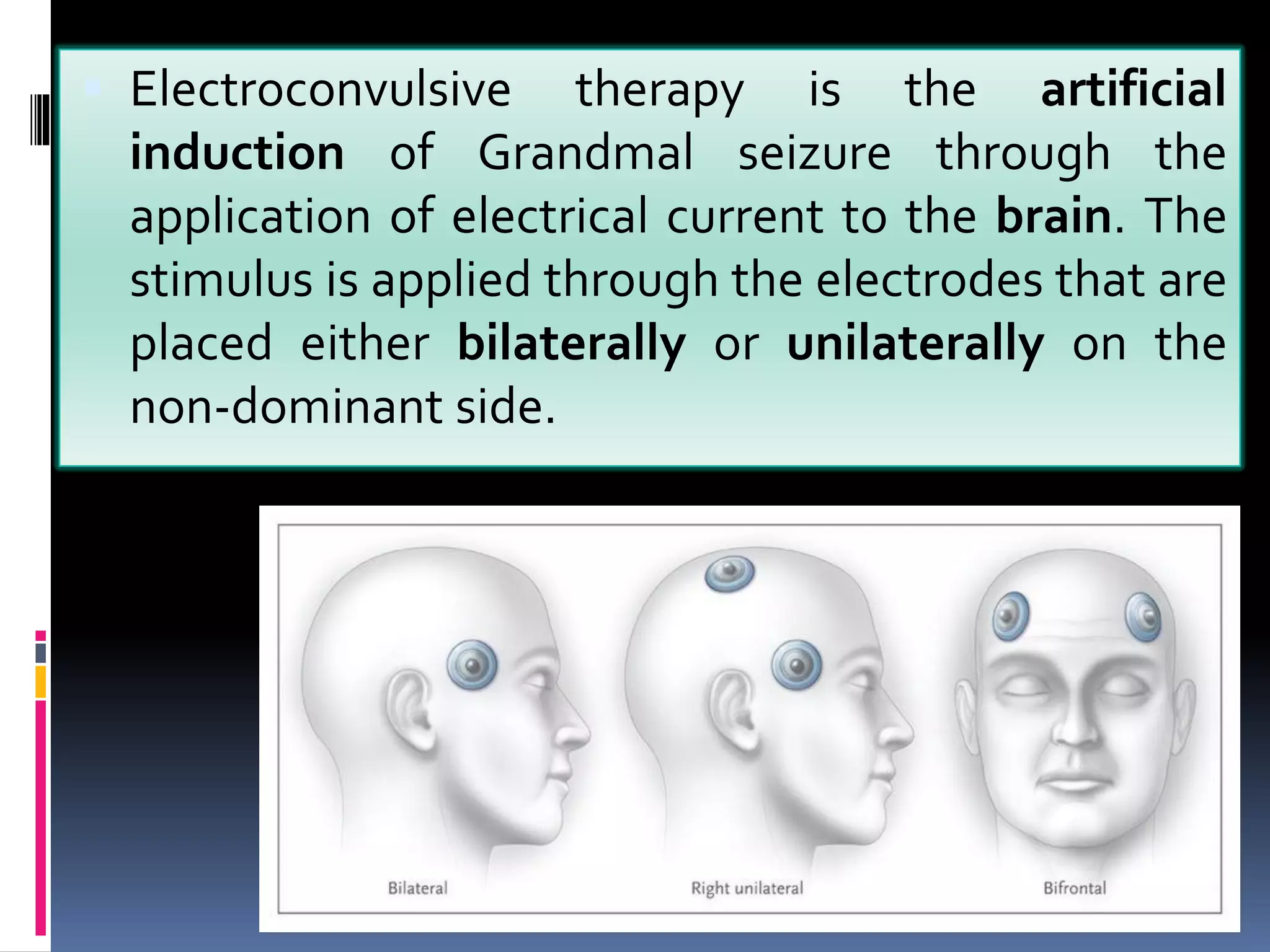 Electroconvulsive therapy (ECT) | PDF