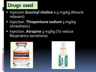 Electroconvulsive therapy (ECT) | PDF