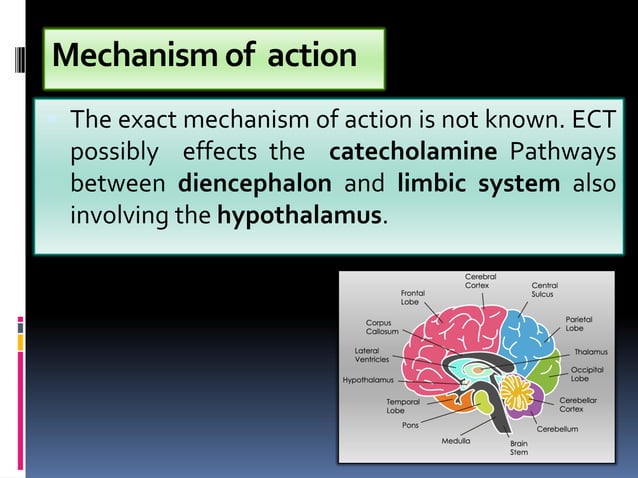 Electroconvulsive therapy (ECT) | PDF