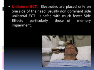Electroconvulsive therapy (ECT) | PDF