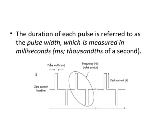 Ect electrical stimulus and procedure | PPT | Physical Therapy | Wellness