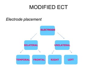 Electroconvulsive Therapy Diagram