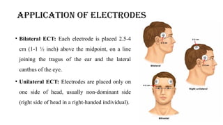 Electro Convulsive Therapy for Nursing students | PPT