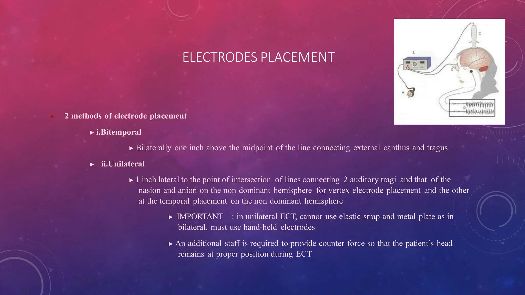 ECT therapy and guidelines for trwatmentpptx | PPT