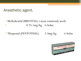 Ect by dr asma | PPT
