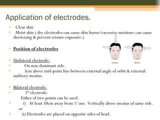 Ect by dr asma | PPT