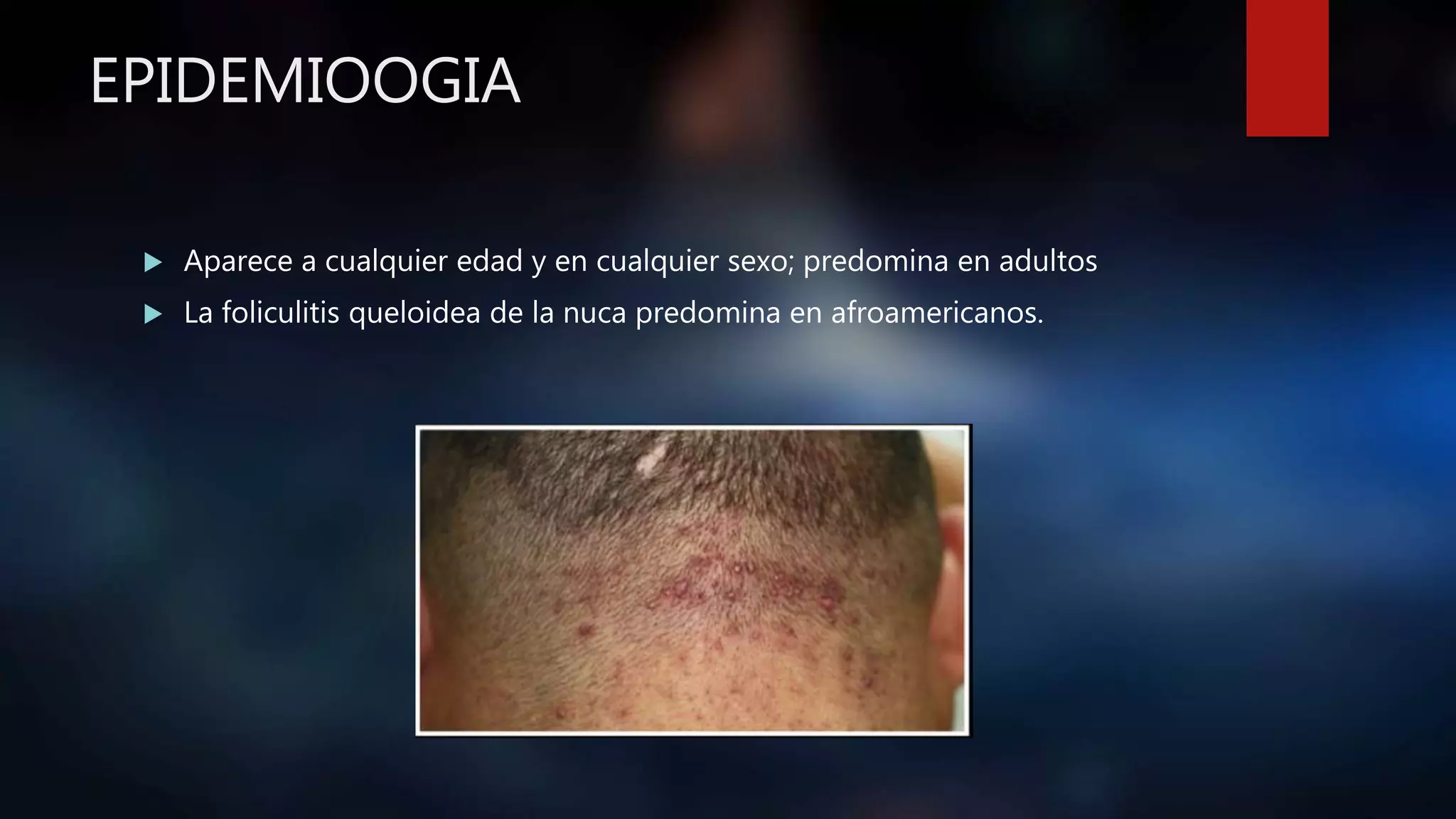 Ectima, eritrasma, hidrosadenitis, impetigo vulgar, folliculitis ...