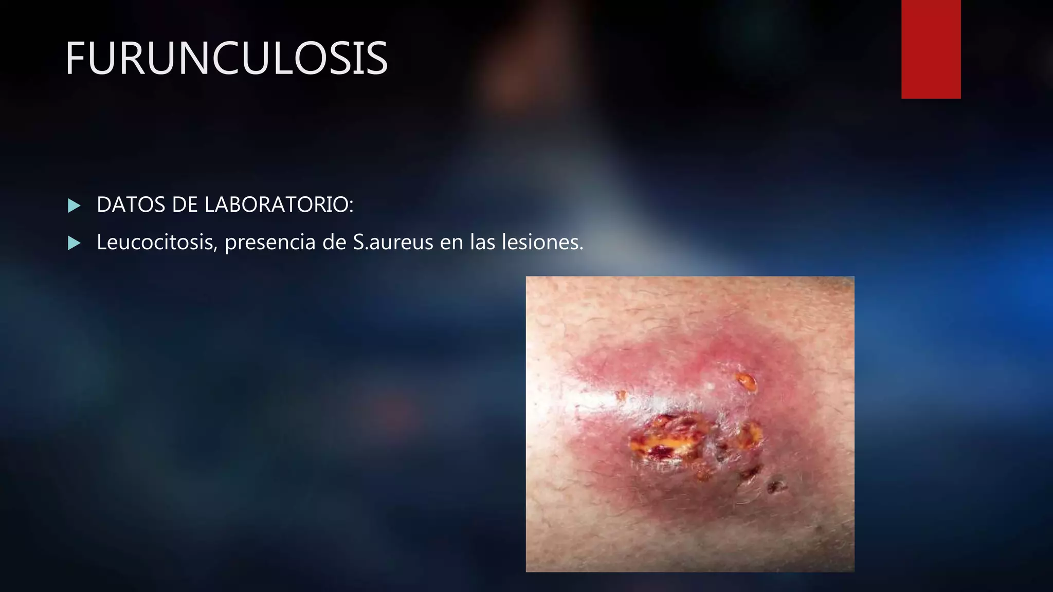Ectima, eritrasma, hidrosadenitis, impetigo vulgar, folliculitis ...