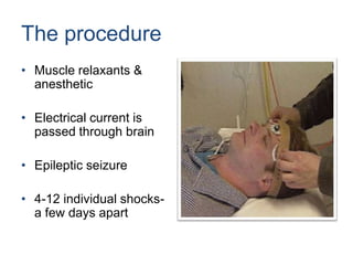Electroconvulsive Therapy | PPTX