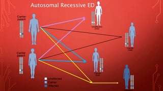 Ectodermal dysplasia | PPTX