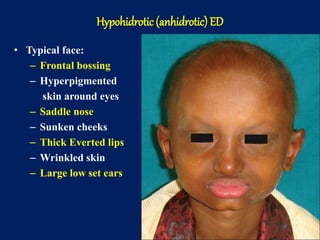 Ectodermal Dysplasia Skin