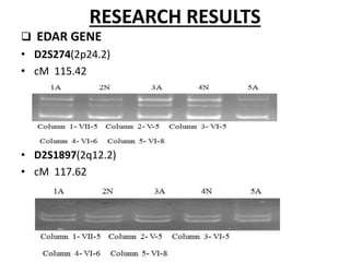 ECTODERMAL DYSPLASIAS | Genetic Disorder | PPTX | Skin and Dermatology ...