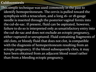 Ectopic pregnancy | PPTX