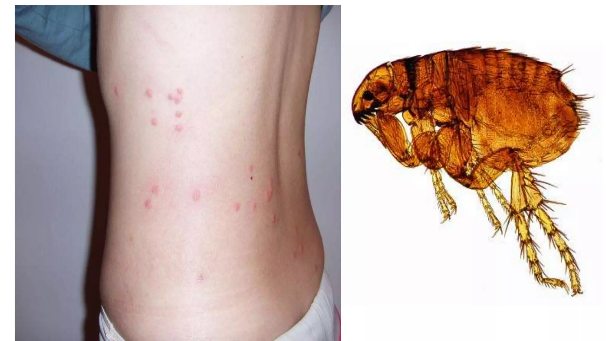 Ectoparasites infestation | PPTX