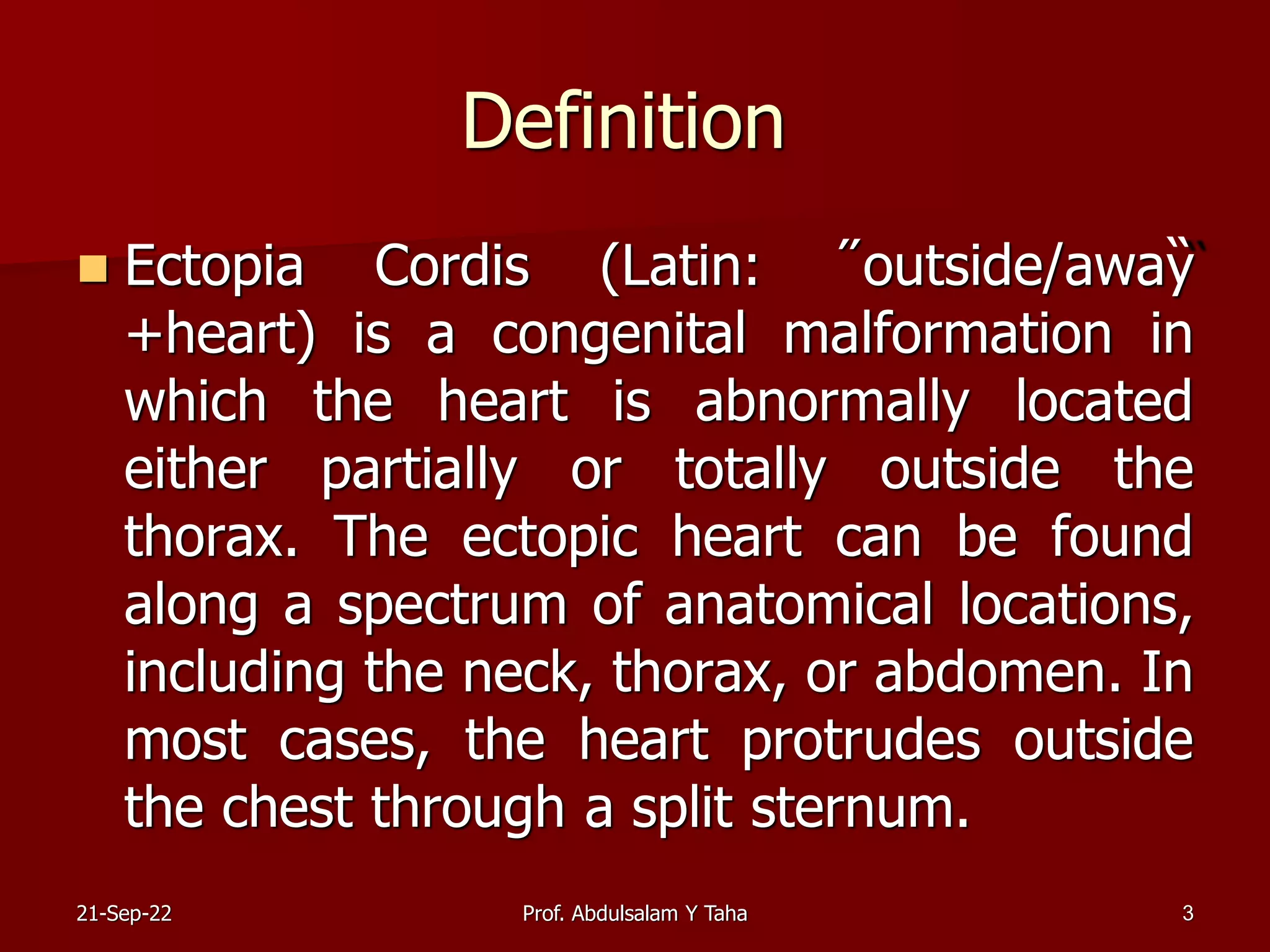 Ectopia Cordis Case Report PPT.pdf