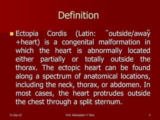 Ectopia Cordis Case Report PPT.pdf