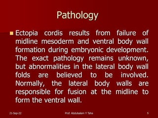 Ectopia Cordis Case Report PPT.pdf