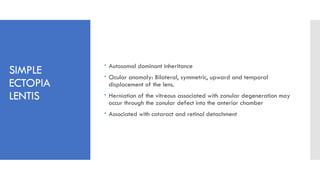 Ectopia lentis classification and management | PPTX