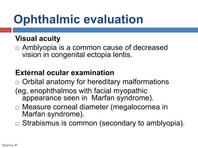 Ectopia lentis and its low vision management | PPTX | Eye and Vision ...