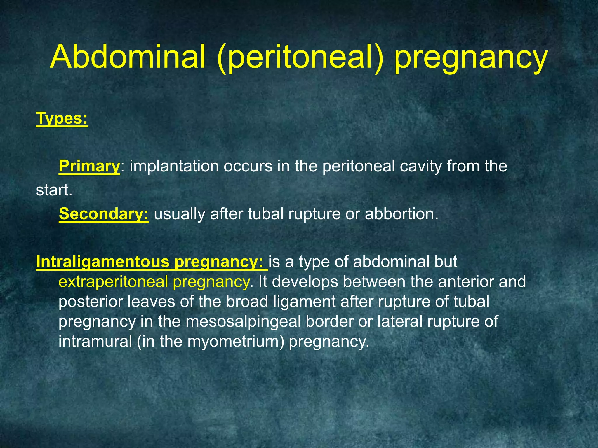 Ectopic pregnancy | PPTX