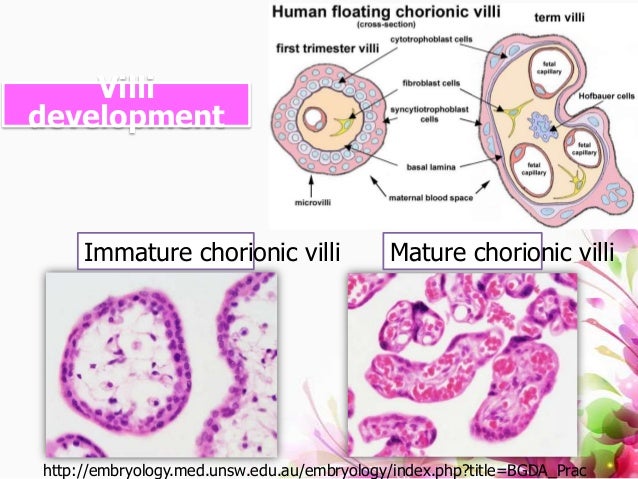 Ectopic pregnancy PBL