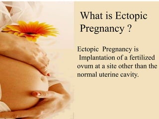 Ectopic | PPTX | Infertility | Reproductive Health