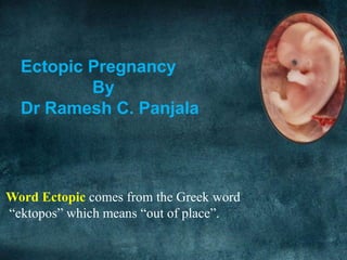 ectopic-.pptx