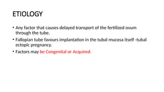 presentation on ectopic pregnancy and its management | PPTX